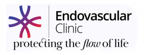 EVLA/EVLT Procedure - Endovascular Clinic